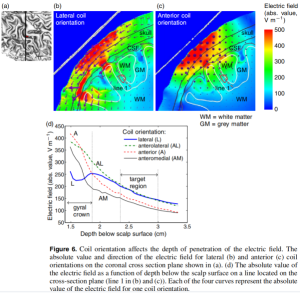 The importance of TMS coil placement