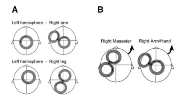 The importance of TMS coil placement