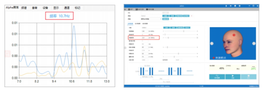 contextual precision to improve the therapeutic effect of TMS device.
