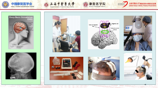 Chapter 1 -Basic theory of non-invasive neuromodulation technology ...