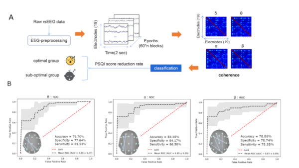 The progress of a serial researches on "rTMS treatment of insomnia ...
