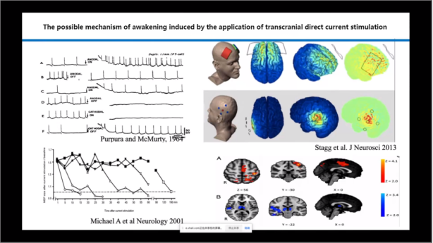 Chapter 5 - The research and application of rTMS and tDCS to promote ...