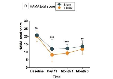 Five times a day accelerated iTBS for fast and efficient treatment of ...