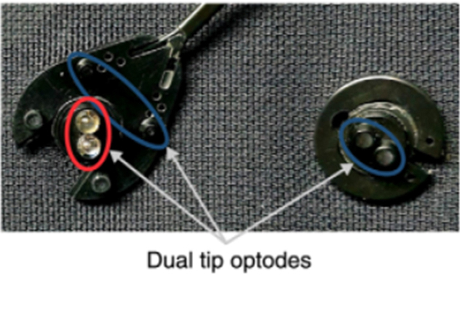 A novel neuromodulation technique
