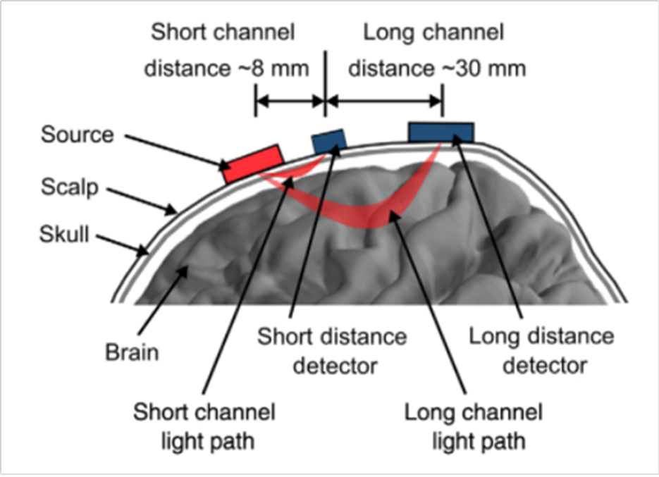 A novel neuromodulation technique